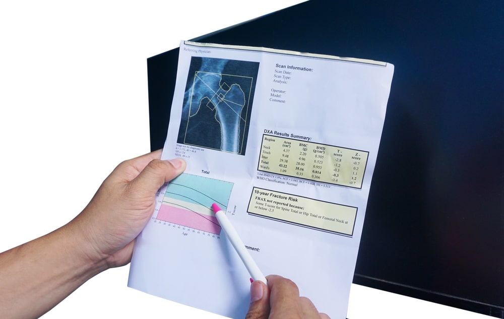 Dexa Scan For Osteoporosis Las Vegas Radiology Dexa Scan For Osteoporosis Las Vegas Radiology